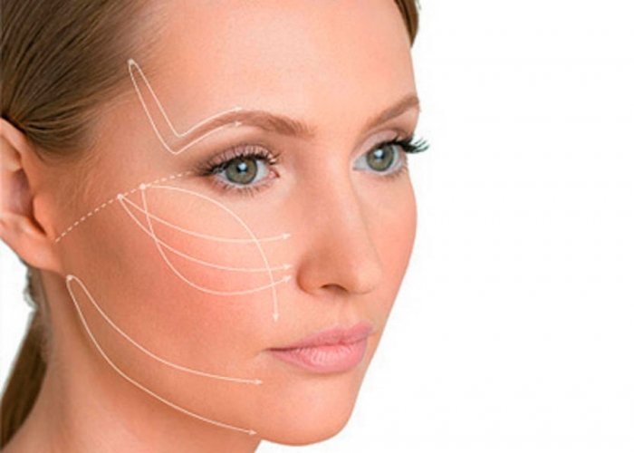 Fio Russo - Fios Tensores Contra Flacidez - Midas Medicina & Estética ...