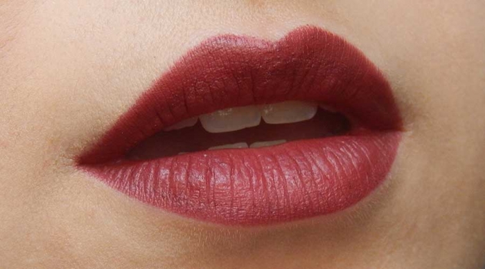 Boca Turbinada com Preenchimento Labial: veja como a técnica funciona ...